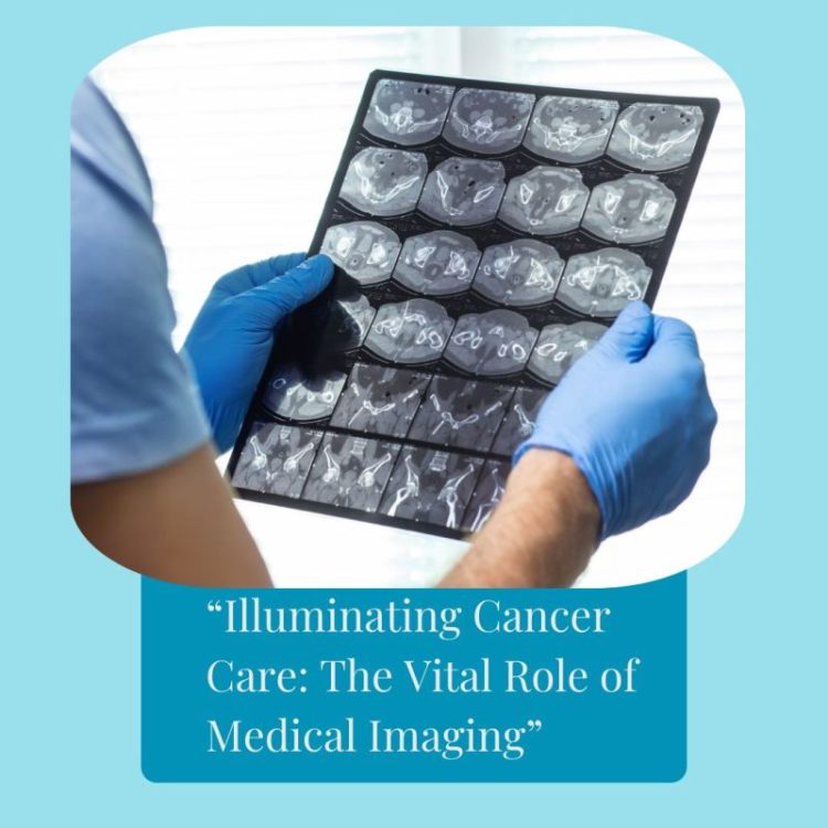 Medical Imaging: Shedding Light on Cancer Diagnosis and Treatment